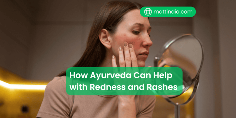How Ayurveda Can Help with Redness and Rashes